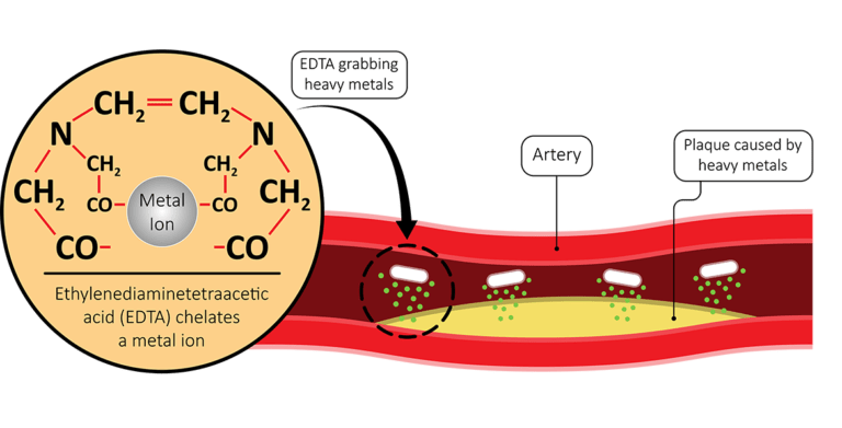 IV Chelation Therapy - Heavy Metal Treatment - Dr. Lalezar
